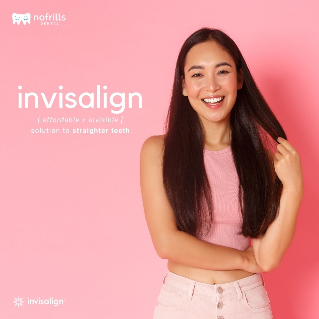 Invisalign Week At Nofrills Dental | Affordable Invisalign Treatment
